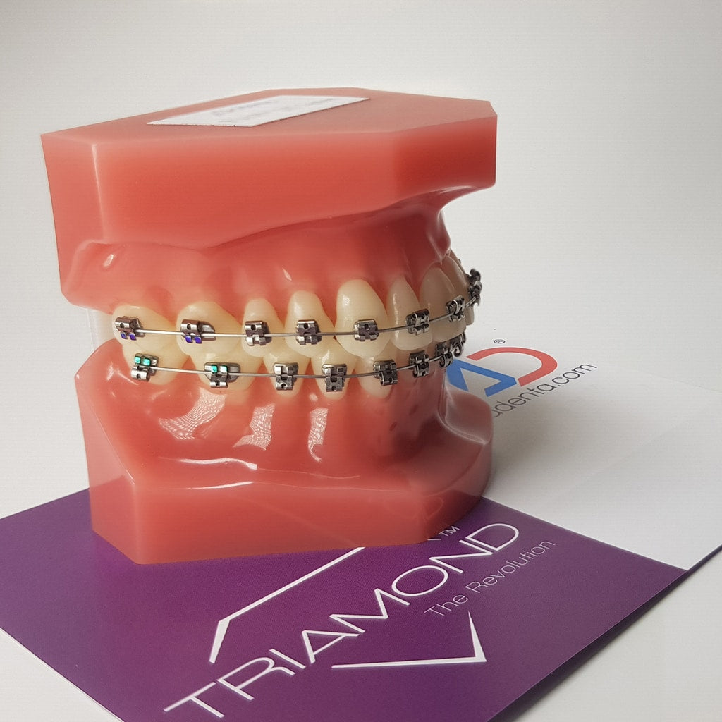 Triamond: Innovative Triangular Slot Bracket System